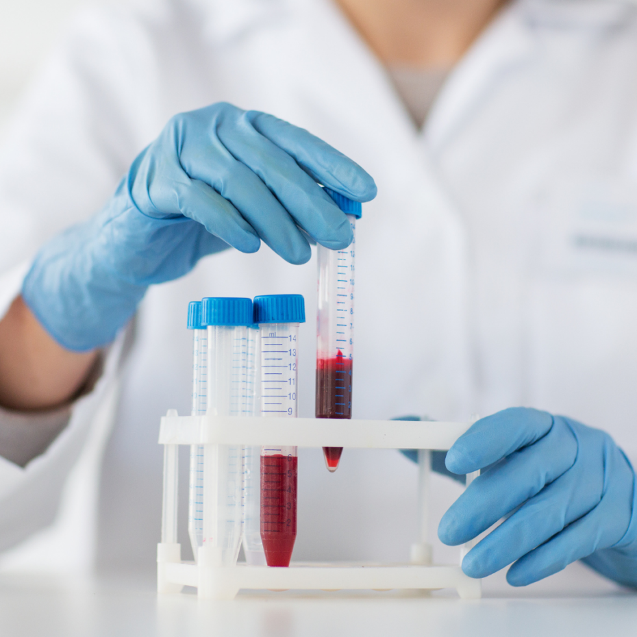 Dissolving Blood Clots – Supportive Care | Peoples Rx Pharmacy